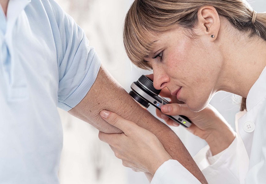 Dermatoscópios | Efe